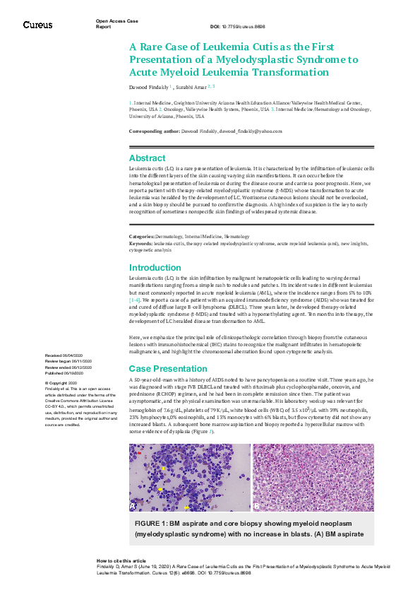 (PDF) A Rare Case of Leukemia Cutis as the First Presentation of a ...