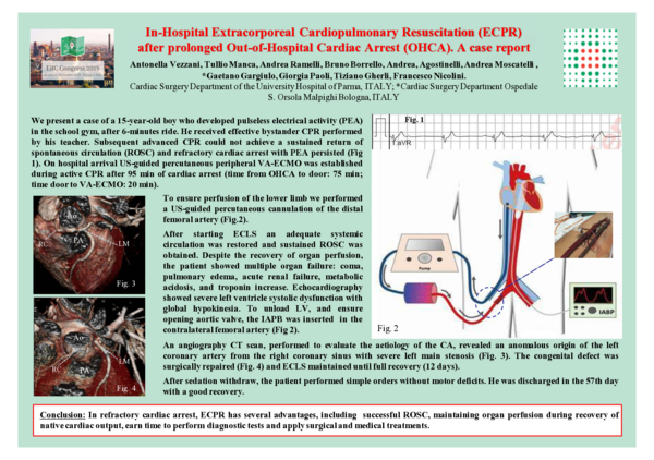 (PDF) In-hospital extracorporeal cardiopulmonary resuscitation (ECPR ...