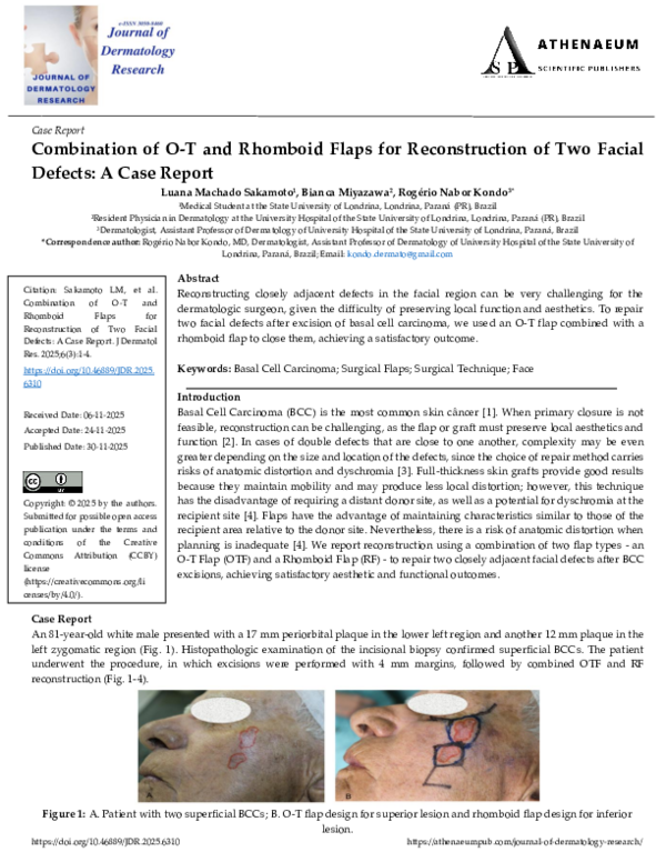 (PDF) Combination of O-T and Rhomboid Flaps for Reconstruction of Two ...