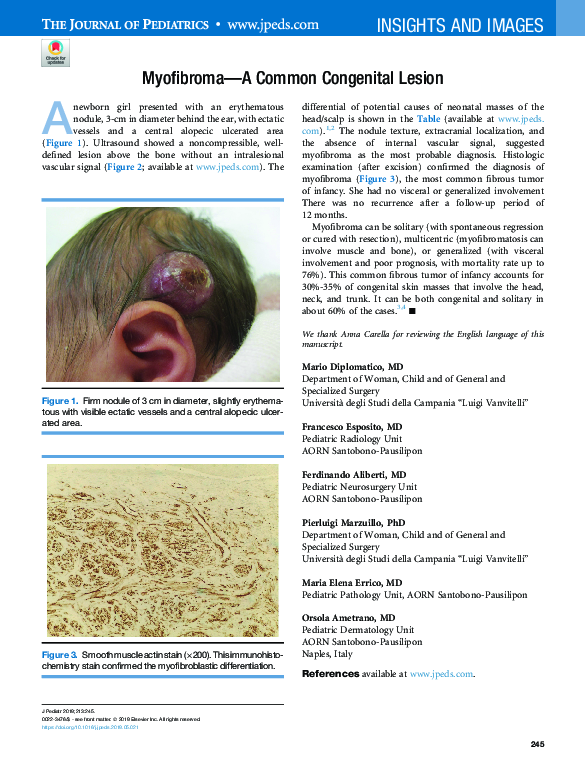 (PDF) Myofibroma—A Common Congenital Lesion