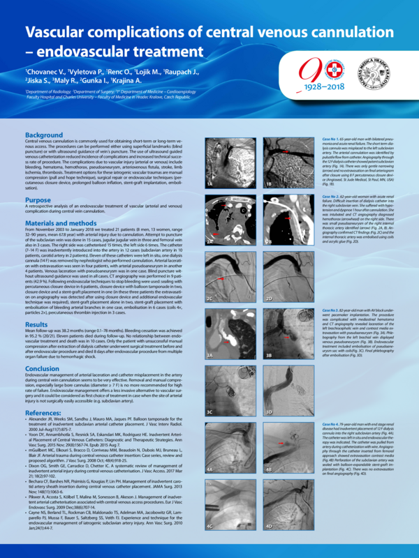 (PDF) Vascular complication of central venous cannulation ...
