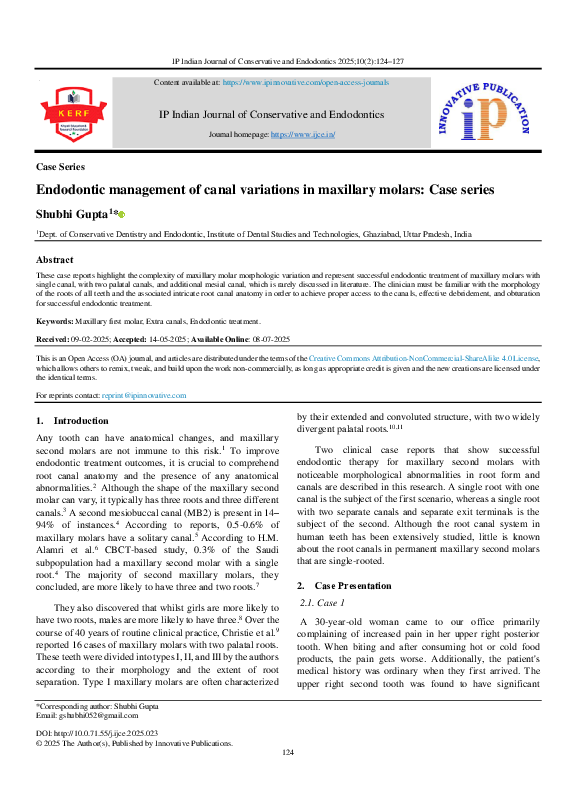 (PDF) Endodontic management of canal variations in maxillary molars ...
