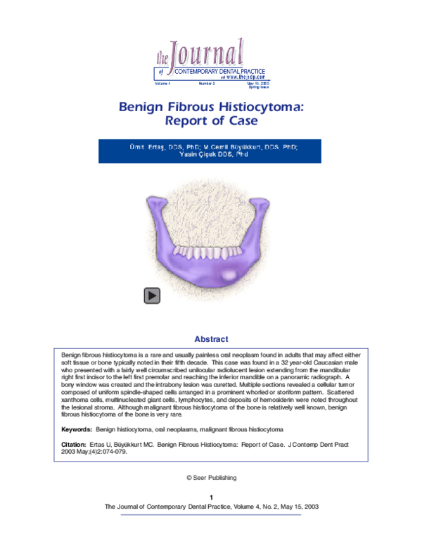 (PDF) Benign Fibrous Histiocytoma: Report of Case