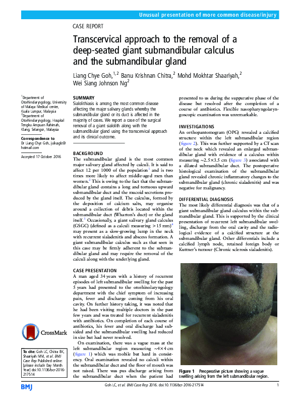 (PDF) Transcervical approach to the removal of a deep-seated giant ...