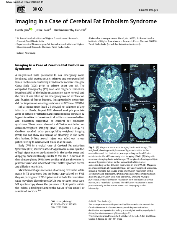 (PDF) Imaging in a Case of Cerebral Fat Embolism Syndrome