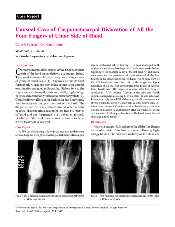 (PDF) Unusual Case of Carpometacarpal Dislocation of All the Four ...
