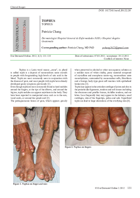 (PDF) Tophus | Piotr Brzezinski - Academia.edu
