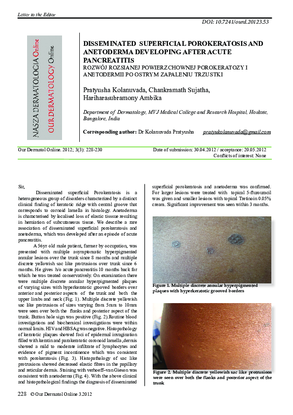 (PDF) Disseminated superficial porokeratosis and anetoderma developing ...