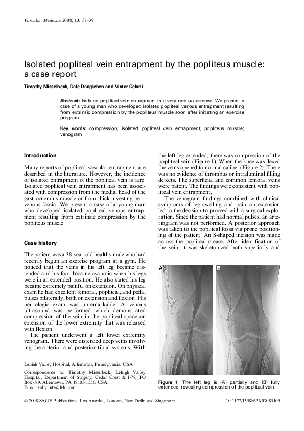 (PDF) Isolated popliteal vein entrapment by the popliteus muscle: a ...