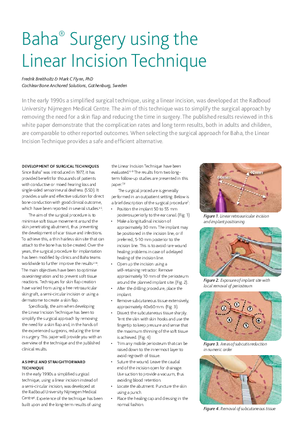 (PDF) Baha® Surgery using the Linear Incision Technique