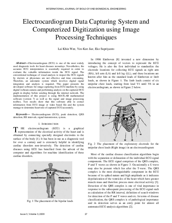 (PDF) Electrocardiogram Data Capturing System and Computerized Digitization using Image ...