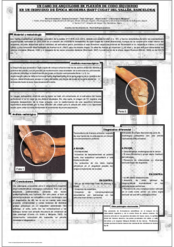 UN CASO DE ANQUILOSIS EN FLEXIÓN DE CODO IZQUIERDO EN UN INDIVIDUO DE ...
