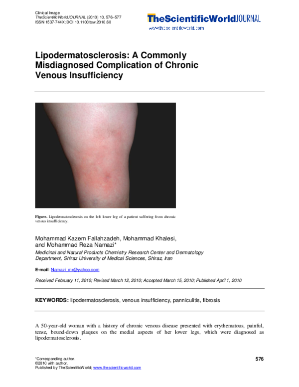 (PDF) Lipodermatosclerosis: a commonly misdiagnosed complication of ...