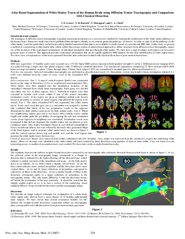 Pdf Atlas Based Segmentation Of White Matter Tracts Of The Human