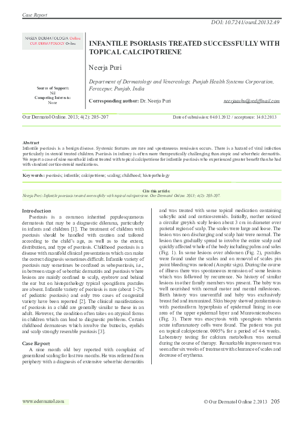 (PDF) Infantile psoriasis treated successfully with topical calcipotriene