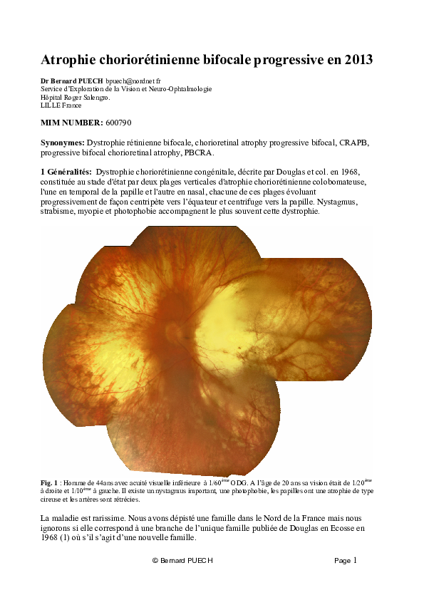 (PDF) Progressive bifocal chorioretinal atrophy in 2012 (Atrophie ...