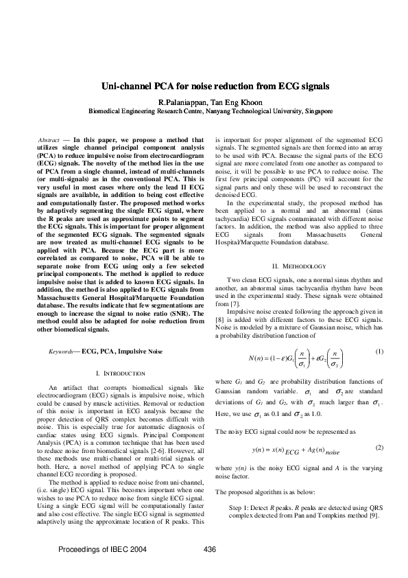 (PDF) Uni-channel PCA for noise reduction from ECG signals