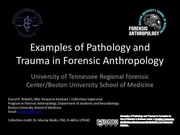 (PPT) Examples of Pathology and Trauma in Forensic Anthropology
