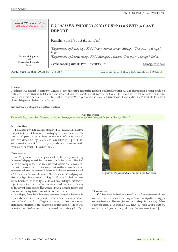 (PDF) Localised involutional lipoatrophy: a case report
