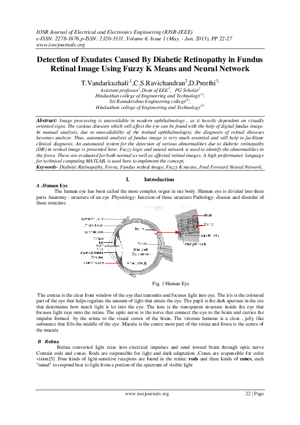 Pdf Detection Of Exudates Caused By Diabetic Retinopathy In Fundus