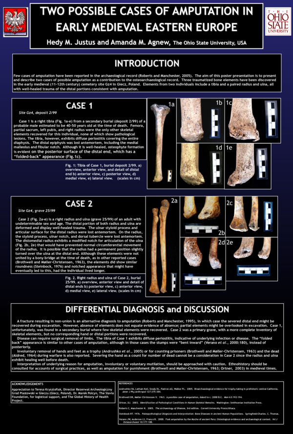 (PDF) Two Possible Cases of Amputation in Early Medieval Eastern Europe