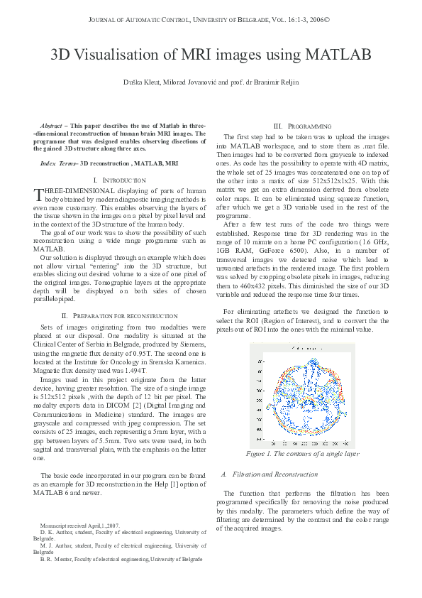 (PDF) 3D Visualisation of MRI images using MATLAB