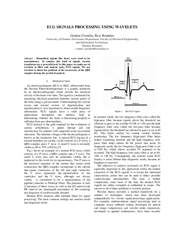 Pdf Ecg Signals Processing Using Wavelets Rahele Azad