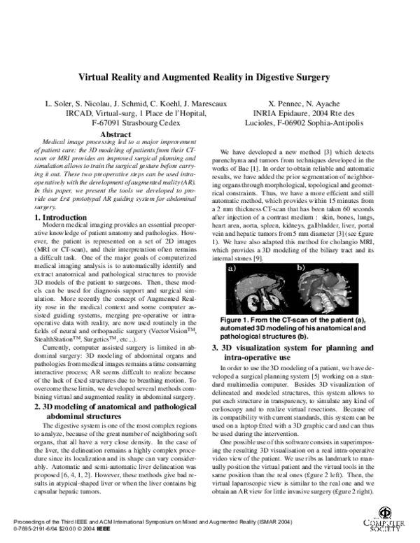 (PDF) Virtual Reality and Augmented Reality in Digestive Surgery