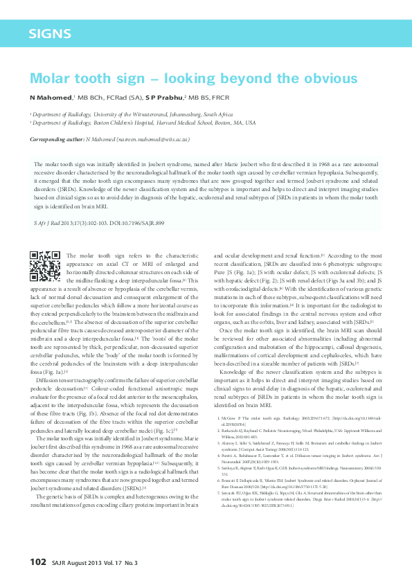(PDF) Molar Tooth Sign