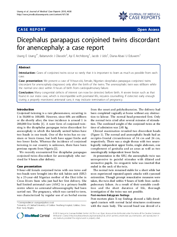 (PDF) Dicephalus parapagus conjoined twins discordant for anencephaly ...
