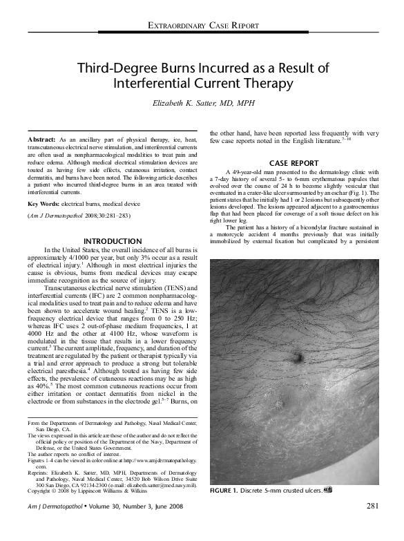 (PDF) Third degree burn inferential therapy