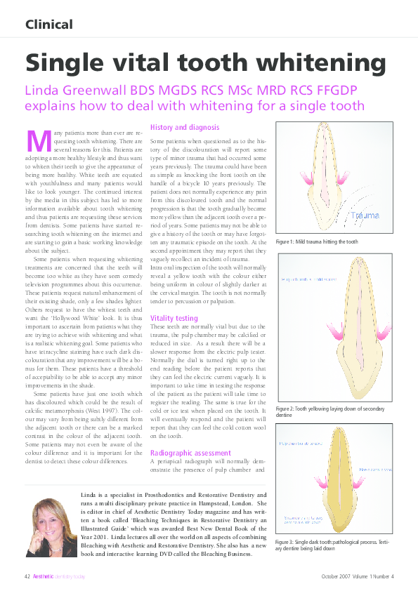 (PDF) Single vital tooth whitening