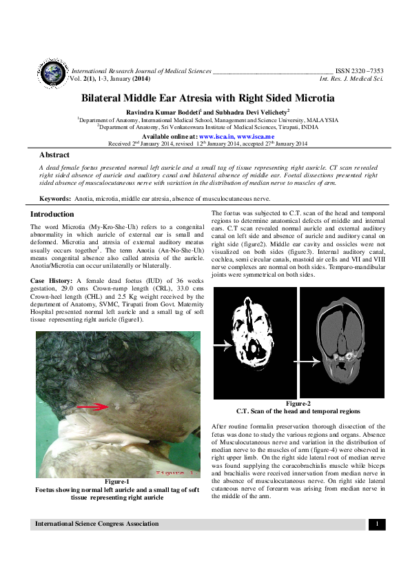 (PDF) Bilateral Middle Ear Atresia with Right Sided Microtia
