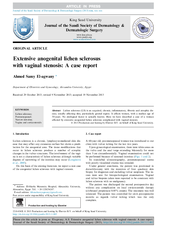 (PDF) Extensive anogenital lichen sclerosus with vaginal stenosis: A case report