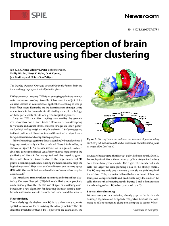 (PDF) Improving perception of brain structure using fiber clustering ...