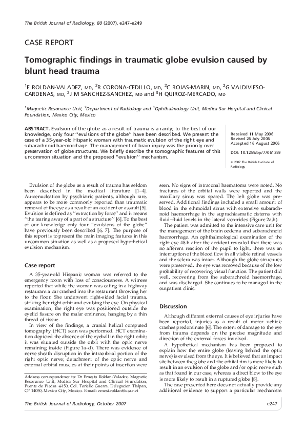 (PDF) Tomographic findings in traumatic globe evulsion caused by blunt ...