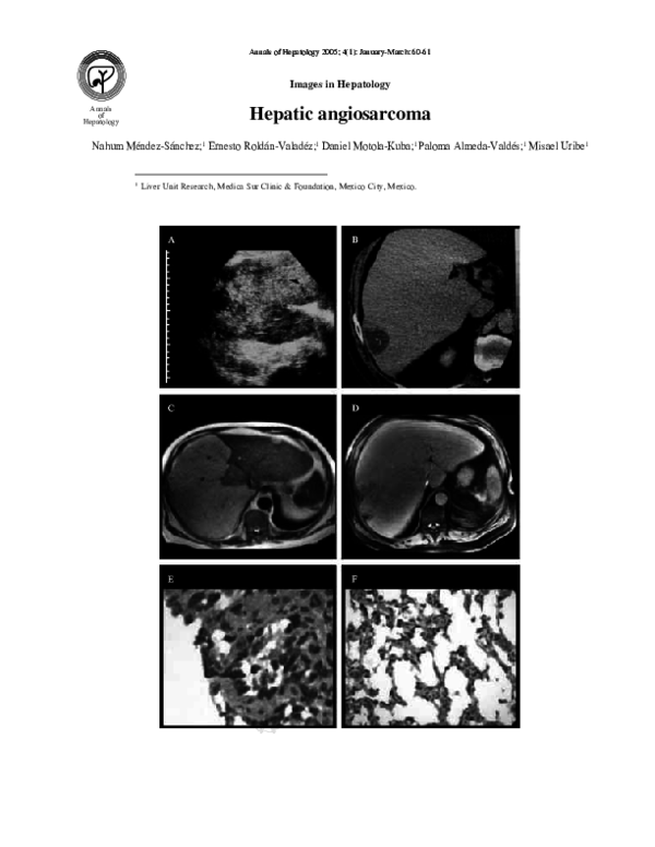 (PDF) Hepatic angiosarcoma