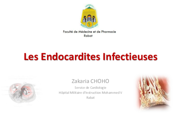 (PDF) Endocardite Infectieuse