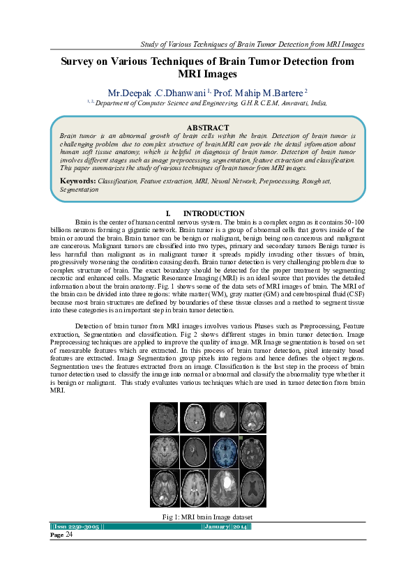 Doc Survey On Various Techniques Of Brain Tumor Detection From Mri Images