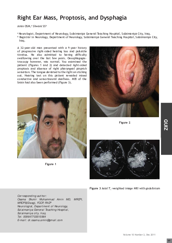 Pdf Right Ear Mass Proptosis And Dysphagia