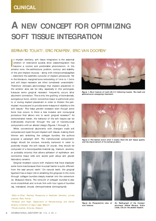 (PDF) A NEW CONCEPT FOR OPTIMIZING SOFT TISSUE INTEGRATION