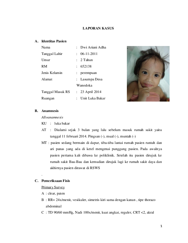 (DOC) LUKA BAKAR PADA ANAK