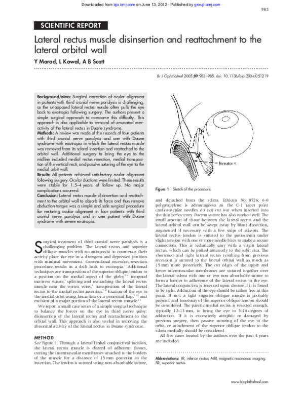 (PDF) Lateral rectus muscle disinsertion and reattachment to the ...