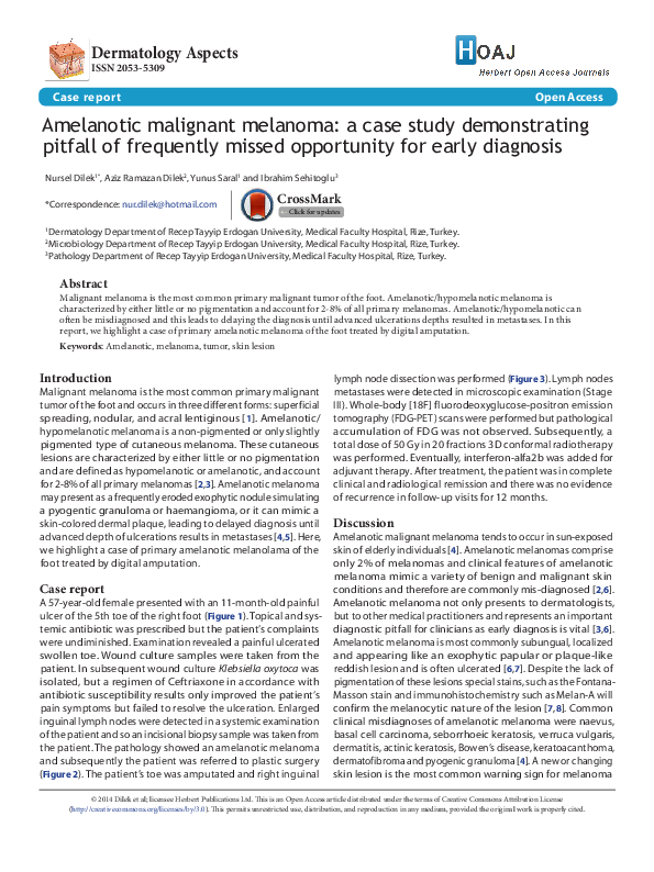 (PDF) Case Note Intra-oral amelanotic malignant melanoma: Report of a ...
