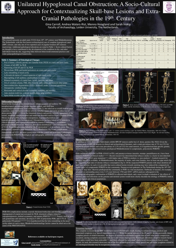 (PDF) Unilateral Hypoglossal Canal Obstruction: A Socio-Cultural ...