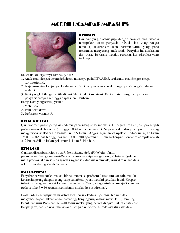 (DOC) MORBILI/CAMPAK/MEASLES