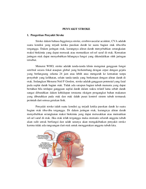 (DOC) paper penyakit strok