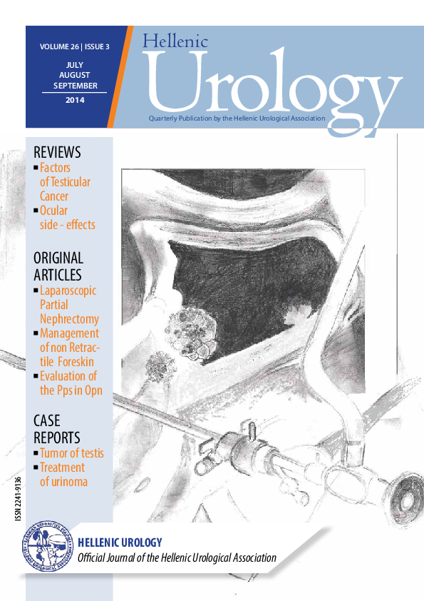 (PDF) Treatment of urinoma due to ureteral perforation by percutaneous ...