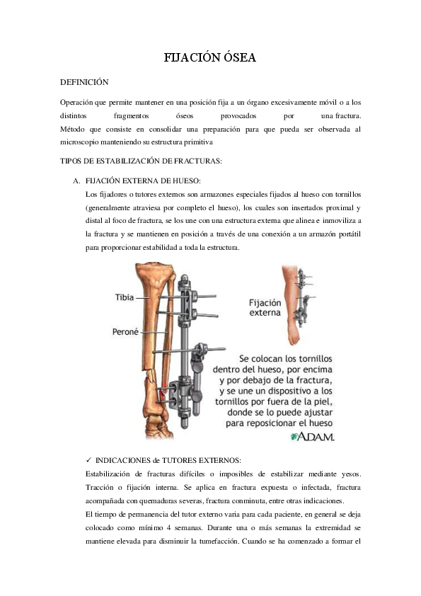 (DOC) FIJACIÓN ÓSEA