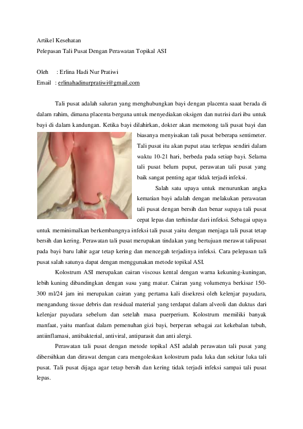(DOC) Artikel Kesehatan Pelepasan Tali Pusat Dengan Perawatan Topikal ASI